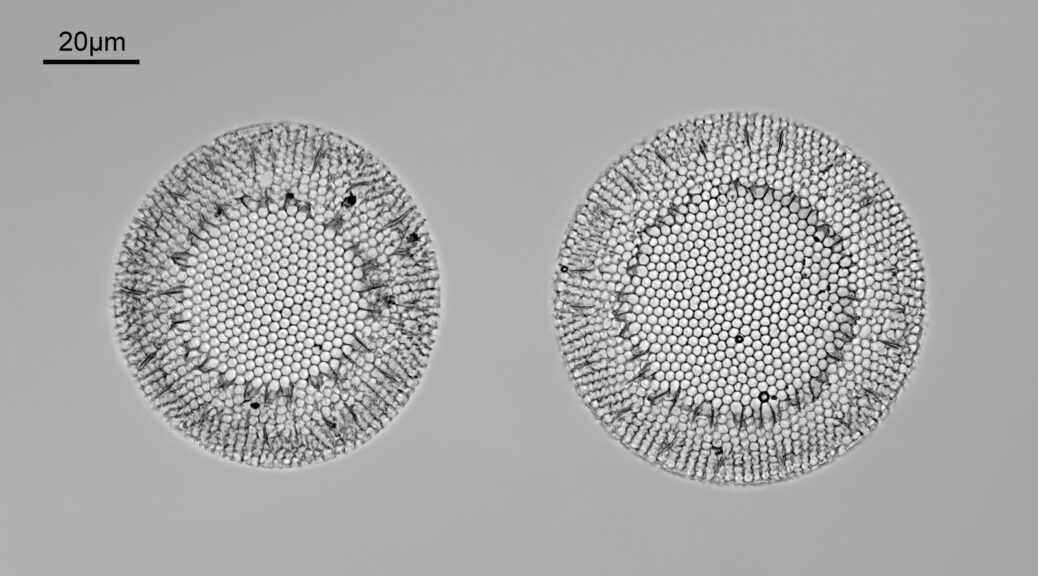Microscopy – Four diatom slides by W.A. Firth | JMC Scientific ...